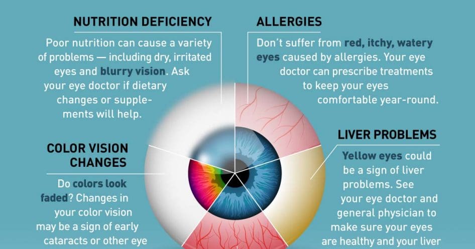 Infographic: 10 Health Problems Your Eyes Could Be Showing Signs Of ...
